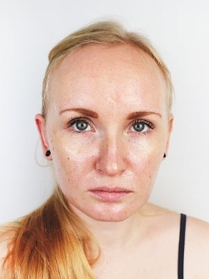 Identify Your Skin Type And Follow The Right Skincare